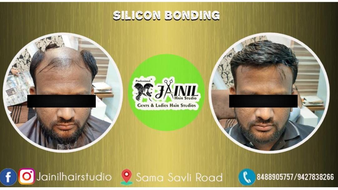 Best Hair Silicon Treatment in Vadodara | Silicon Bonding